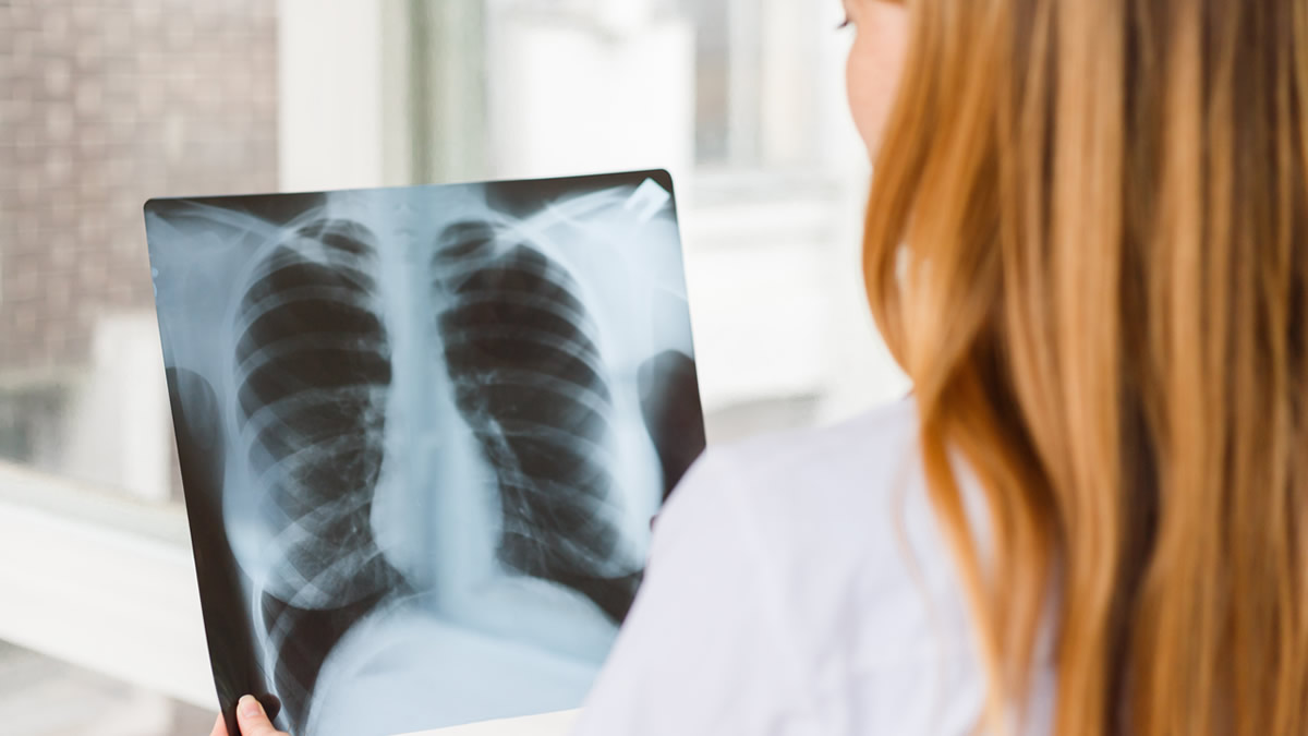 Pulmologija | Specijalna bolnica Medico